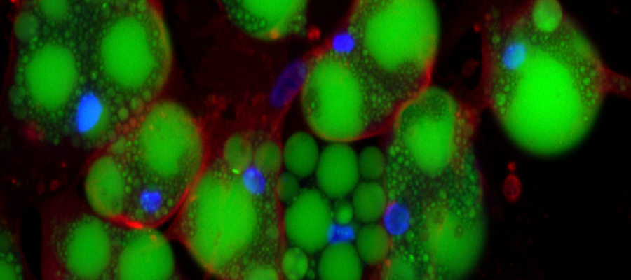 Lab-grown fat cells offer promise for cultivated meat | The Roslin ...