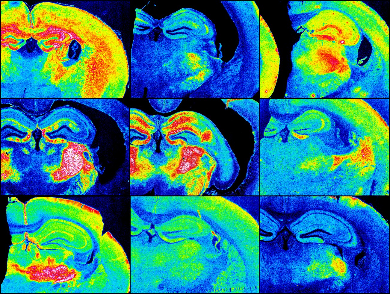 Identification of prion diseases aided by novel marker | The Roslin ...