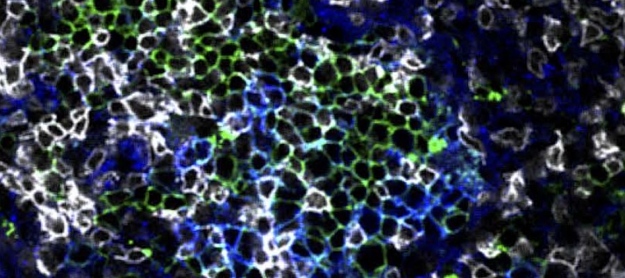 Lung tissue forms immune cell hubs when needed | The Roslin Institute ...